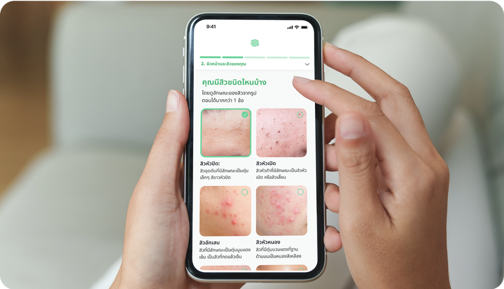 SkinID - Acne Serum custom made for you